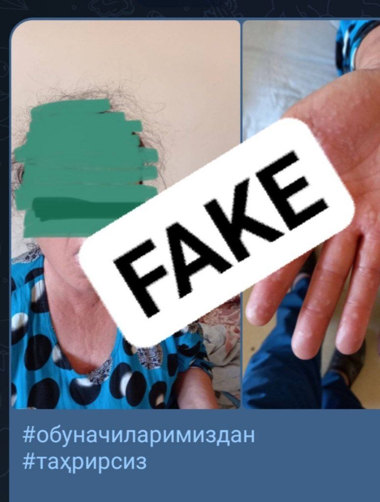 Аndijonda "maymun chechak"ga chalinish holati qayd etilgani rostmi?